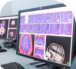 Gamma Knife - Macquarie Neurosurgery & Spine